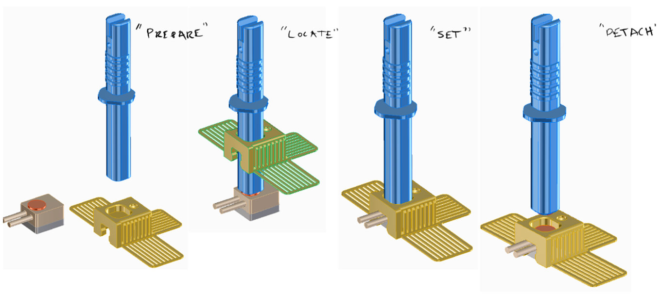 OHSU Vascular Monitoring: Case Study | Simplexity