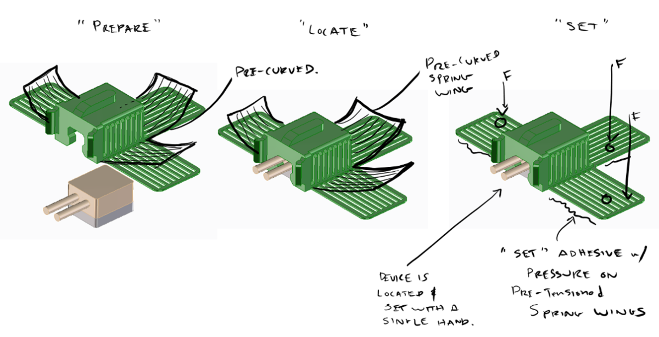 OHSU Vascular Monitoring: Case Study | Simplexity